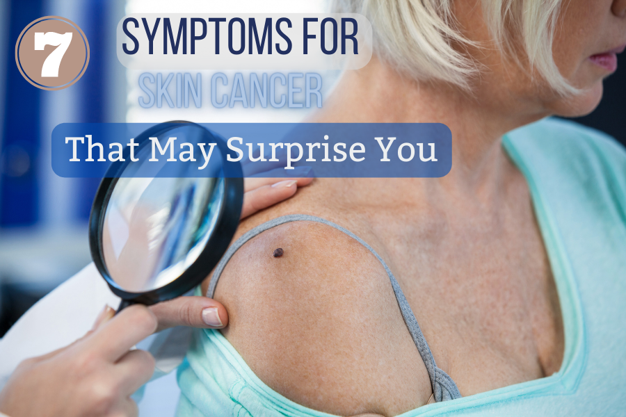 7 Symptoms For Skin Cancer That May Surprise You